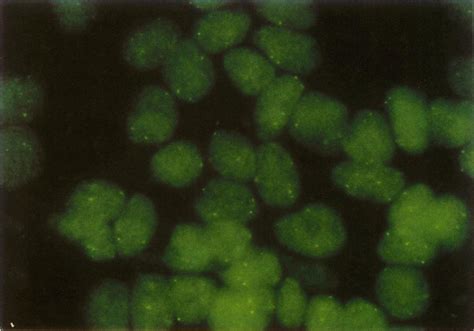 FISH Analysis Of The APC Locus Download Scientific Diagram