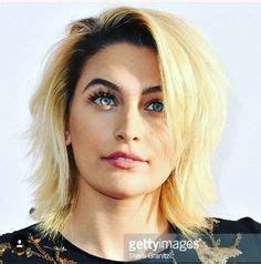 4 Famous People With Waardenburg Syndrome