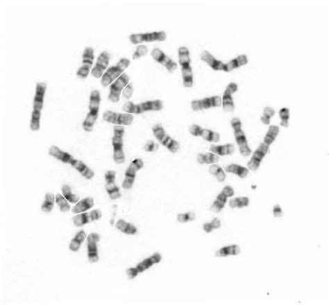 Cell Nucleus In Metaphase Stage We Start By Inverting The Colored Cell Download Scientific