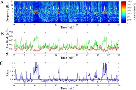 Automatic Detection Of Highly Organized Theta Oscillations In The