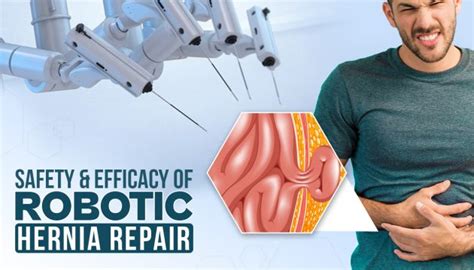 Robotic Hernia Surgery Archives Yashoda Super Speciality Hospital