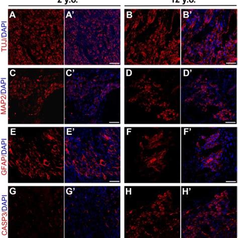 Effects Of Age On Expression Patterns Of Neuronal And Glial Markers In Download Scientific