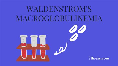 Waldenström Macroglobulinemia Overview Causes Symptoms Treatment