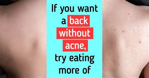 6 Tips To Get Rid Of Body Acne And Bring Back Your Confidence Healthw