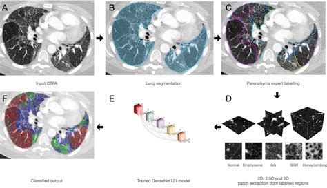 Schematic Of The Methodology For Patch Based Approach To Classify Lung Download Scientific