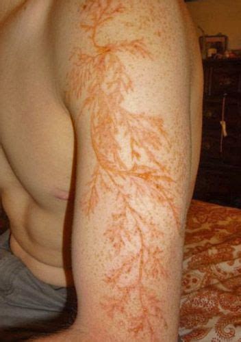 Lichtenberg Figures Artofit