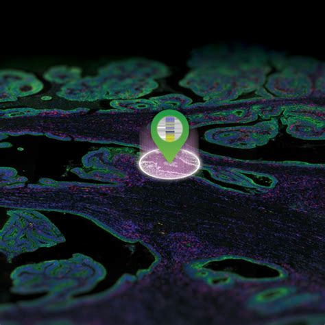Geomx Digital Spatial Profiler Nanostring