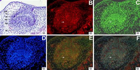 Similar Expression Patterns Of Fhl2 And Runx2 In The Mouse Molar Germ