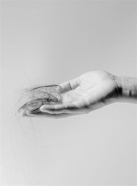 How To Deal With Hair Loss