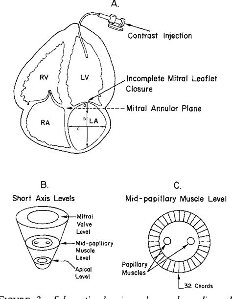 Papillary Muscle Dysfunction Semantic Scholar