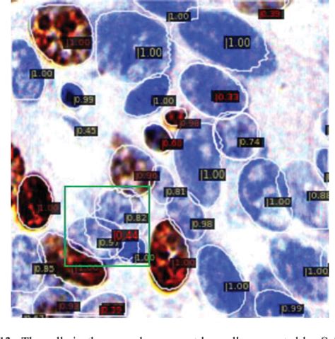 Figure 12 From Oriented Cascade Mask R Cnn For Biomedical Image Segmentation Semantic Scholar