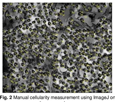 Figure 1 From Auto Segmentation Of Lymph Node Microscopy Images Semantic Scholar
