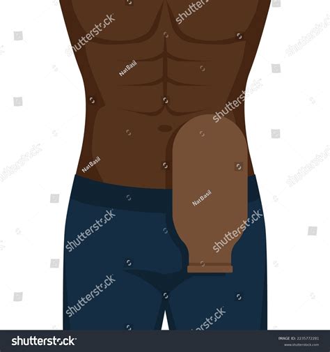 Black Man Colostomy Bag After Colon Stock Vector Royalty Free 2235772281 Shutterstock