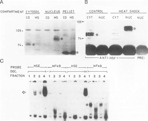 Subcellular Localization Of Hsf1 Cytosolic Soluble Nuclear And Download Scientific Diagram