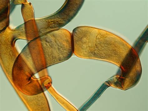 The Hidden Line Of Microscopic Fungi 05 Fungi Cuff Bracelets Jewelry