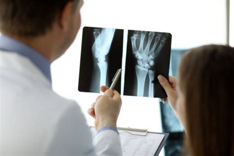 Is Motion Analysis Being Under Utilized In Upper Limb Analysis Vicon