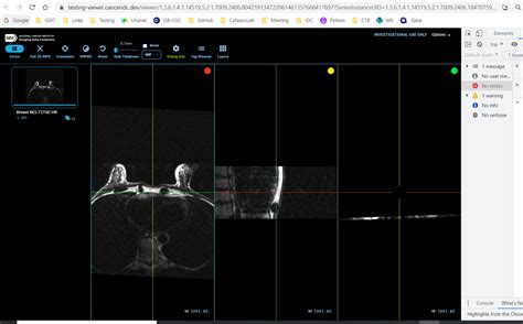 Test Tier Send Bug Report Button Is Not Working · Issue 1131 · Imagingdatacommonsidc Webapp