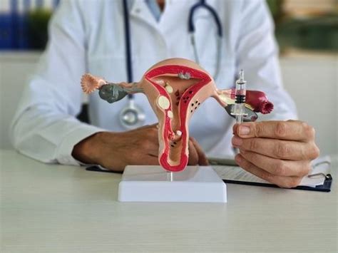 Ovulation Induction A Guide To Infertility Treatment