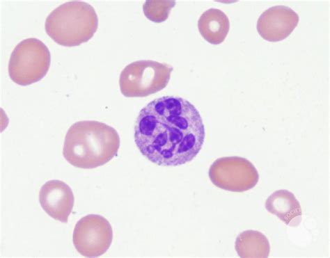 Segmented Neutrophil