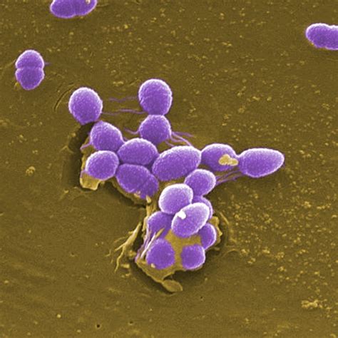 Enterococcus Faecalis Infection