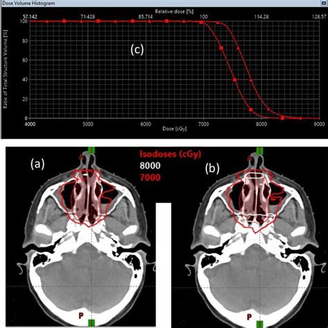 An Example Of The Different Dose Distributions Calculated With The Pb Download Scientific