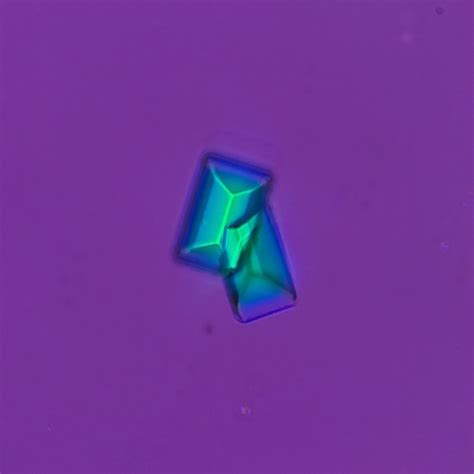 Triple Phosphate Crystals Identification And Clinical Significance