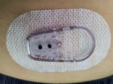 연속 혈당측정기 덱스콤g6 리뷰 Vs 리브레가격 구매처 사용법 네이버 블로그