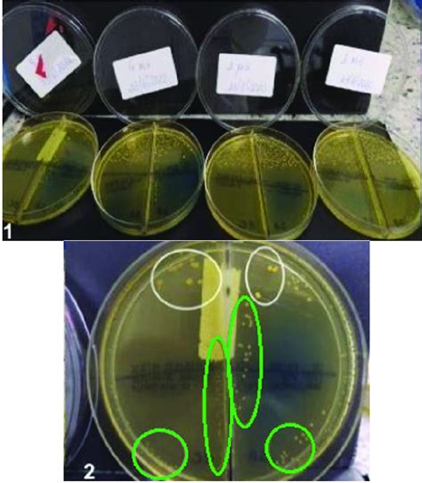 On The Left Are The Plates Exposed To UVC Radiation For And Download Scientific