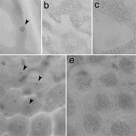 Sex Chromatin In Interphase Nuclei Of Adult Ostrinia Furnacalis