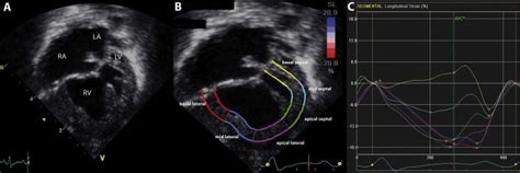 Beware Of Life Threatening Activation Of Air Bubble Detector During