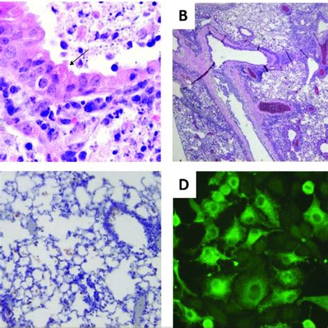 Sev Infection Of A Mouse Lung A Small Eosinophilic Cytoplasmic Download Scientific Diagram