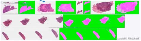 (病理图像质控)分割病理图像(whole Slide Images,wsi)中包含组织的区域,去掉空白区域文末有代码链接 掘金 (病理图像质控)分割病理图像(whole Slide Images,wsi)中包含组织的区域,去掉空白区域文末有代码链接 掘金