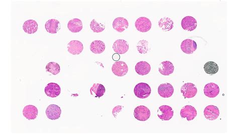 Digital Spatial Profiling Services Tristar