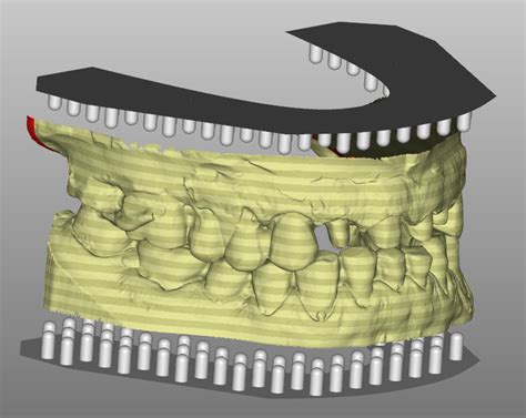 Model Creator Module Exocad