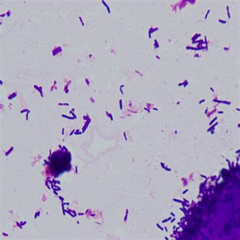 Multiclass Object Detection Model By Bacilli