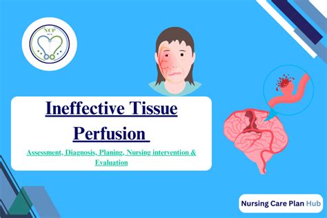 Ineffective Tissue Perfusion Care Plan Due To Cva Ncphub