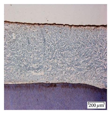 Runx2 Expression In A Collagen Spheroids Dentin B Collagen