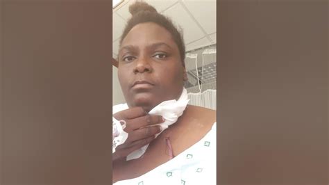 Thyroidectomy Surgery Youtube