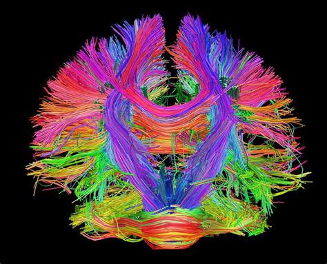 A Map Of The Connections In A Human Brain Human Brain Brain Science