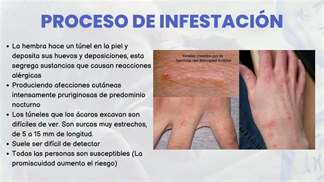 Que Es La Escabiosis Pdf