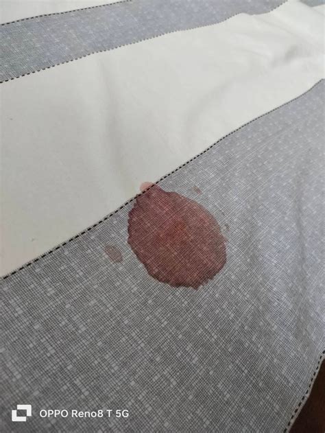 Thai Gf Started 🩸 Today With An Accident Rttotm
