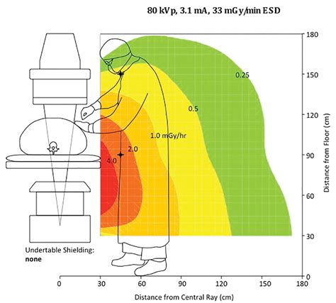Radiation Risk To The Fluoroscopy Operator And Staff Ajr