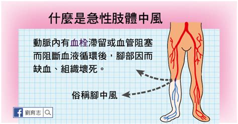 腳也會中風注意急性肢體中風的5個警訊懶人包家天使居家照顧