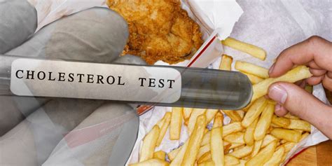 Mauvais Cholestérol Ces Aliments Qui Le Favorisent Marie Claire