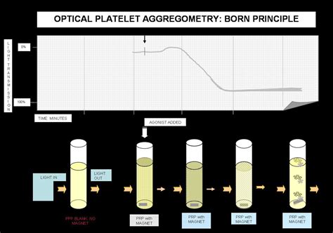 Elevated Platelet Function Assay At Rachel Fairweather Blog