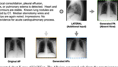 Figure From Unified Chest X Ray And Radiology Report Generation Model With Multi View Chest X