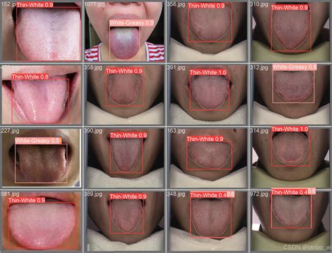 基于yolov10的舌象检测识别系统，支持图像、视频和摄像实时检测【pytorch框架、python源码】yolov10 舌象检测识别系统 Csdn博客