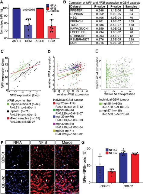 Nfia And Nfib Share A Similar Expression Pattern In Astrocytoma A Download Scientific Diagram