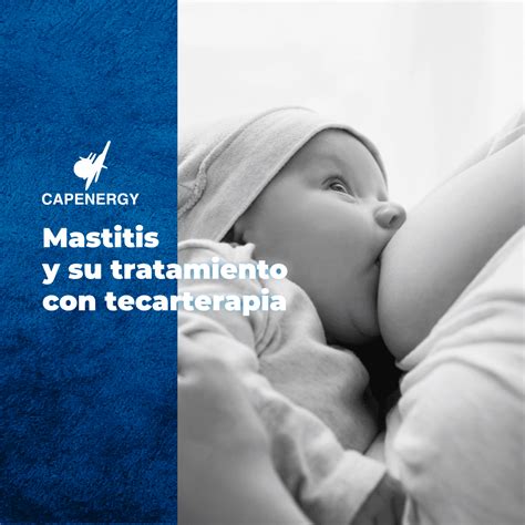 Mastitis Y Su Tratamiento Con Tecarterapia Capenergy Medical