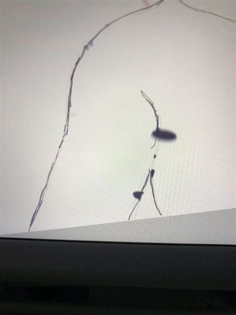 Help Gen 1 Apple Pencil Not Responding Correctly Rapplepencil